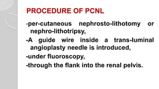 Nephrolithotomy | PPTX | Surgery | Medical Health