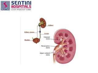 Nephrology case management and chronic kidney disease | PPT