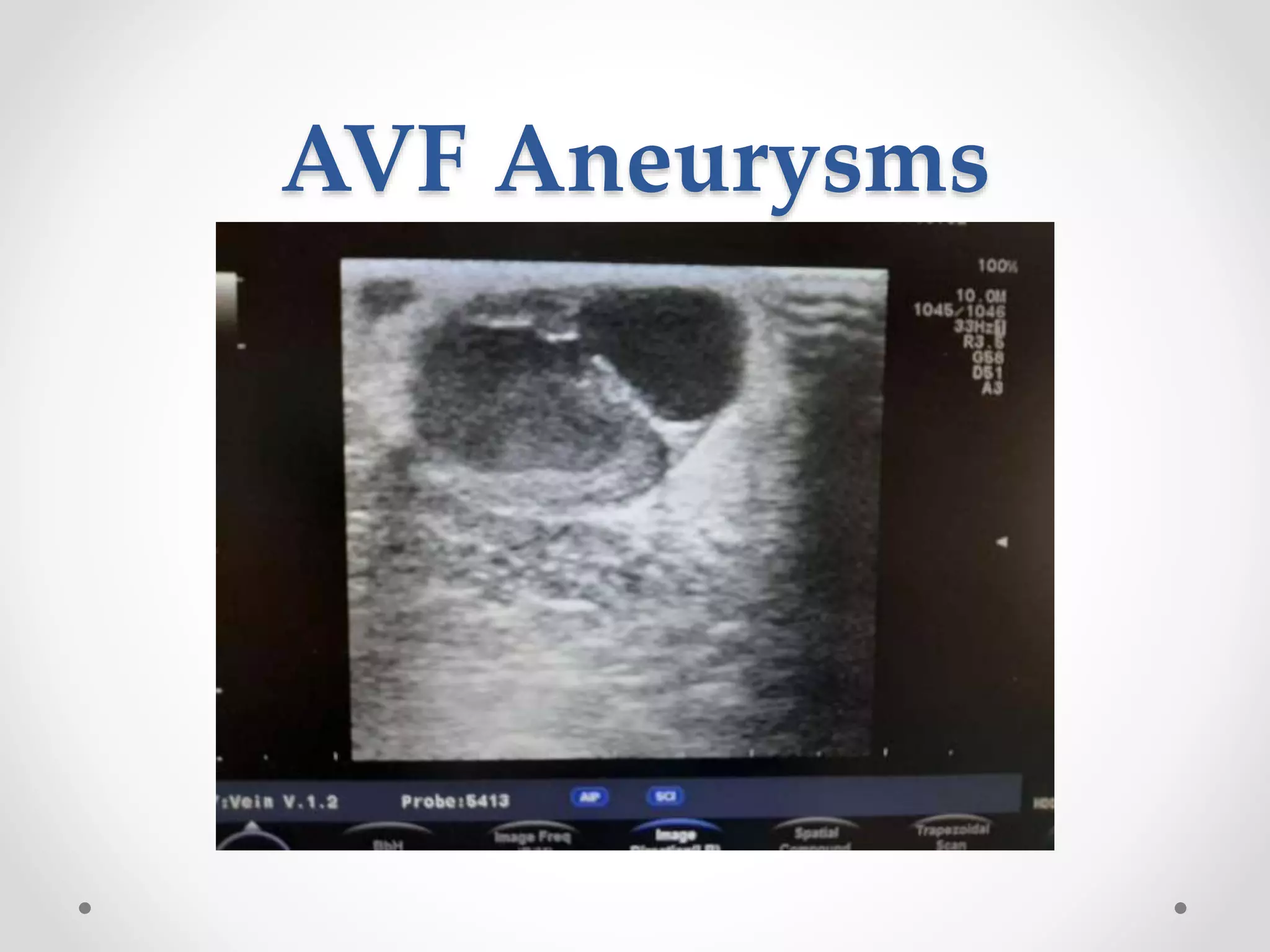 Vascular access Complications Surveillance / Troubleshooting | PPT