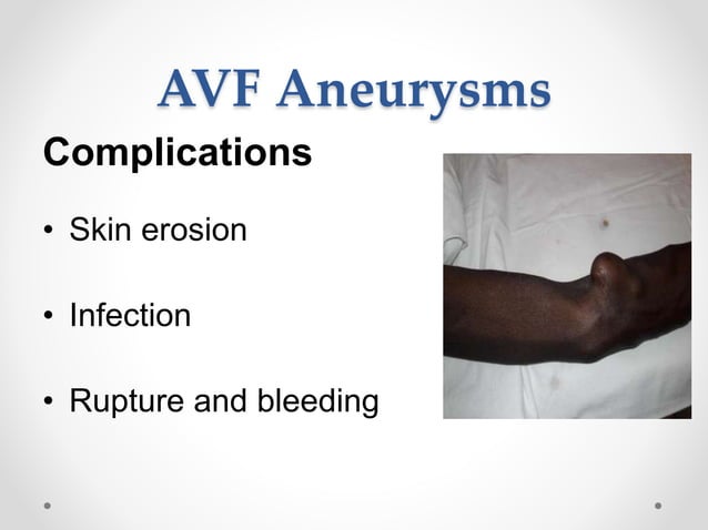 Vascular access Complications Surveillance / Troubleshooting | PPT