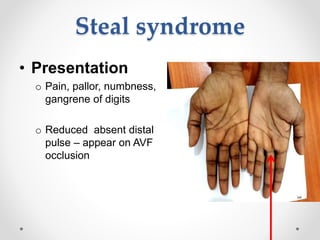 Vascular access Complications Surveillance / Troubleshooting | PPT