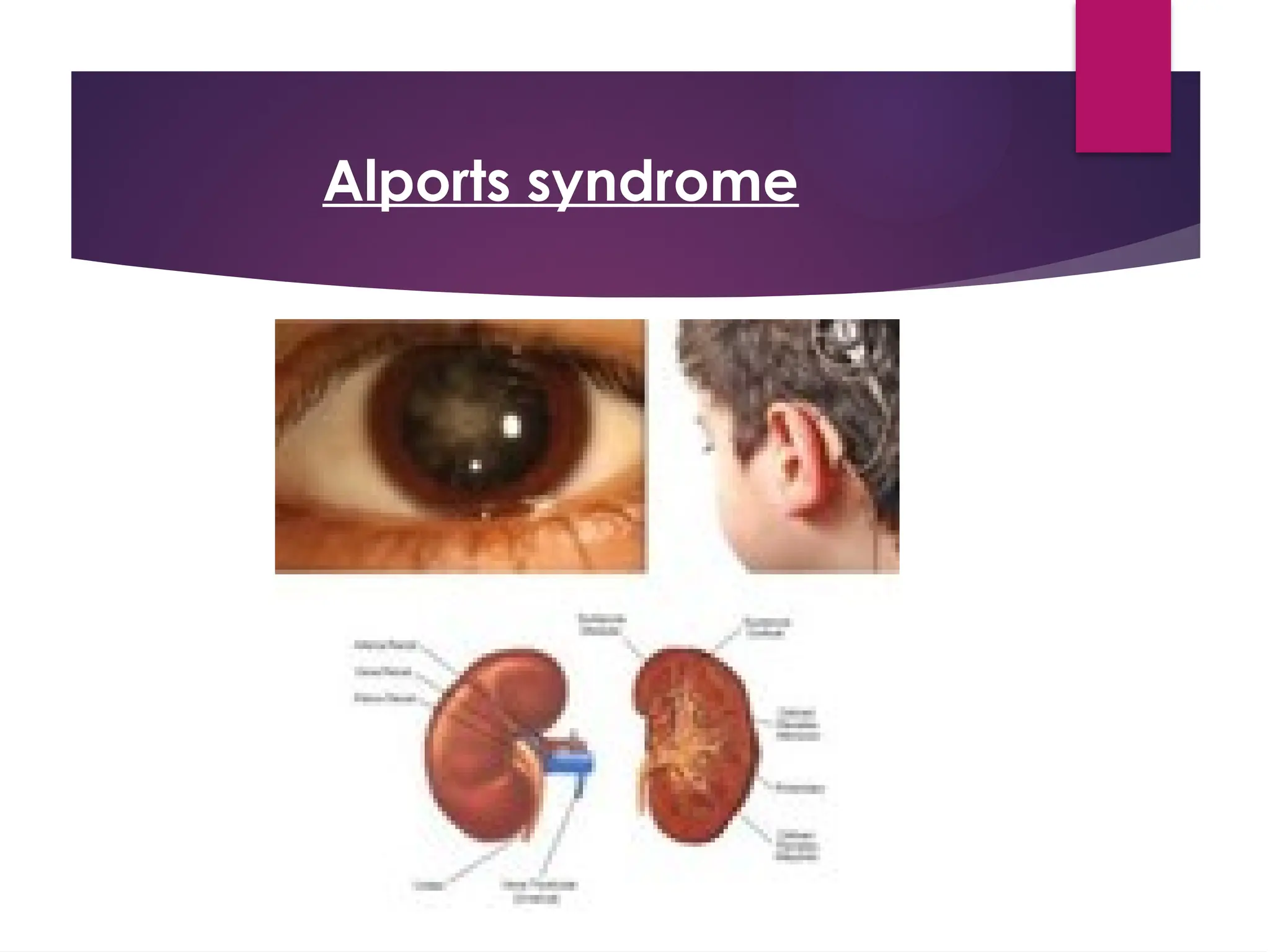 Nephrology in Images presentation of nephro | PPTX