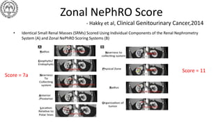 Nephrometry | PPTX