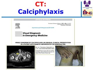Nephroradiology pres-course-13-april-2017 (1) | PPTX