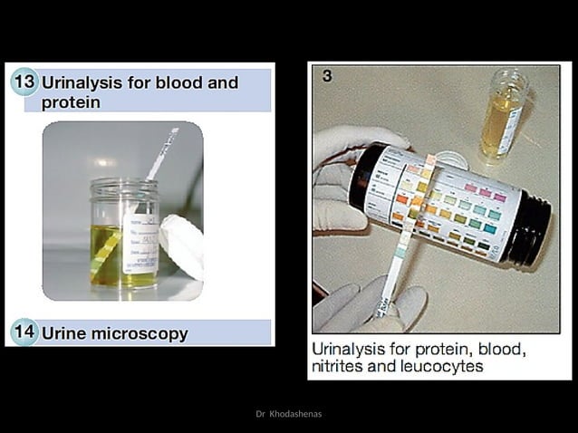 nephro semiology for medicalstudents.pptx