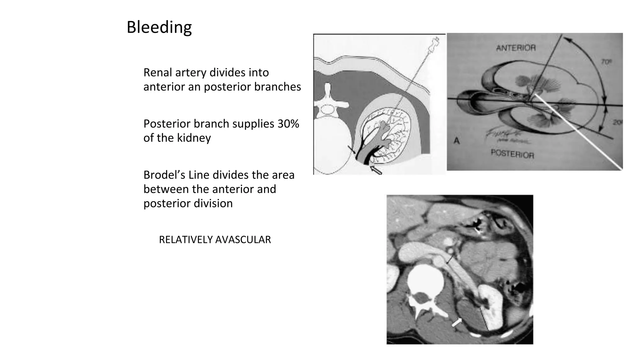 Nephrostomy tube eduaction for patiens | PPTX