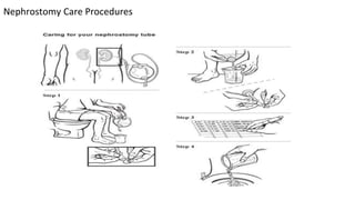 Nephrostomy tube eduaction for patiens | PPTX