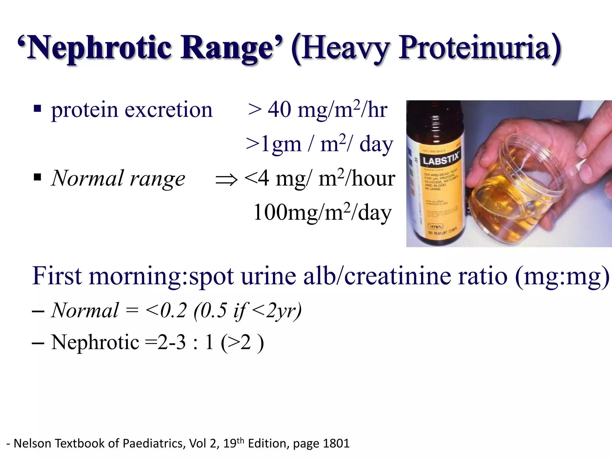 Nephrotic syndrome treatment update by Dr. G.Malini | PPTX