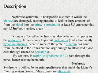 nephrotic syndrome.ppt………………………………………….. | PPT