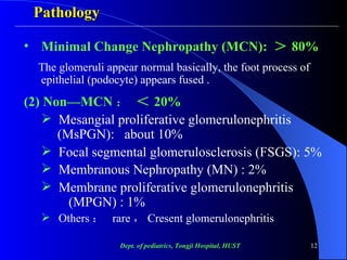 Nephrotic Syndrome | PPT