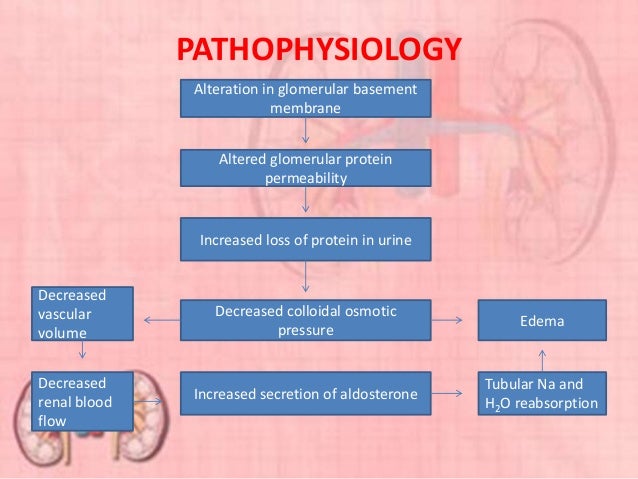 Nephrotic syndrome