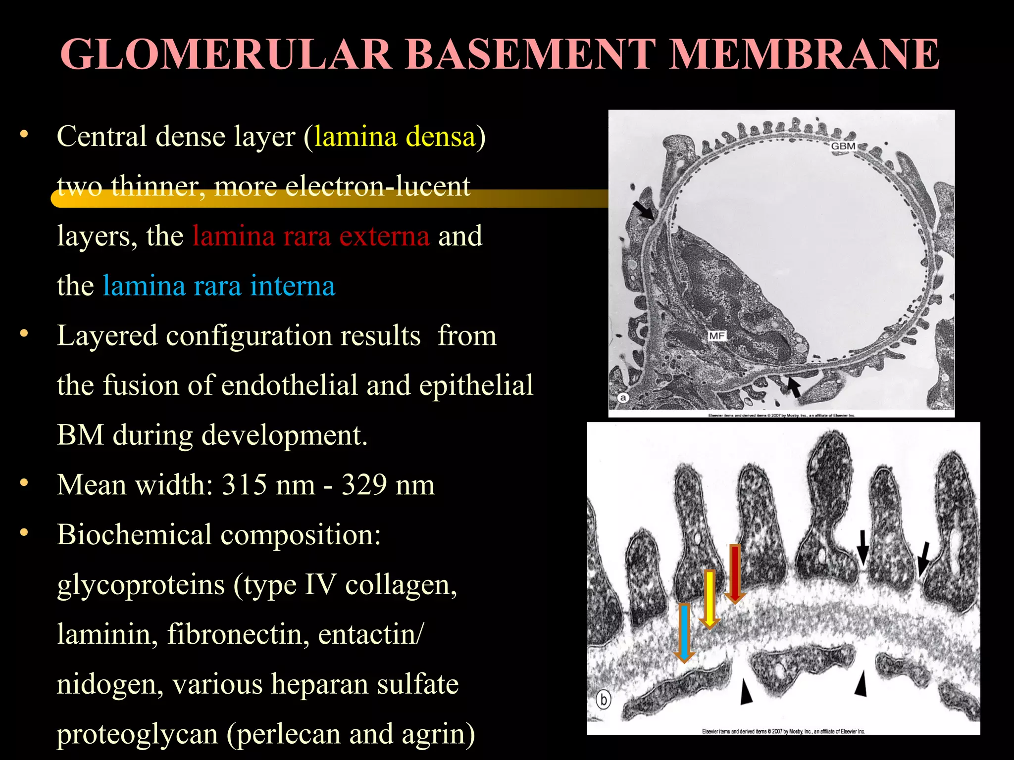 Nephrotic syndrome (Glomerulonephritis) | PPT
