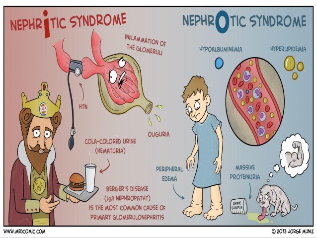 Nephrotic syndrome