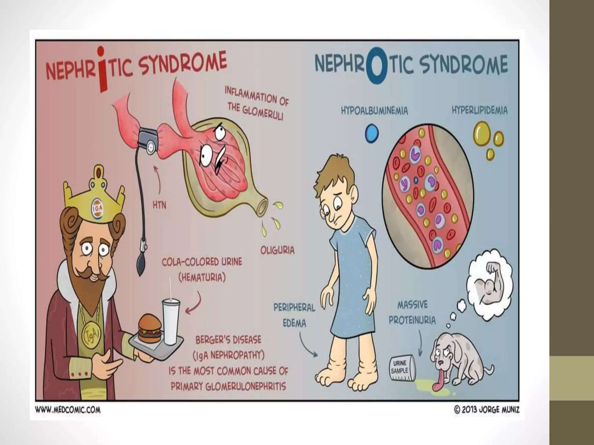 Nephrotic Syndrome.pptx