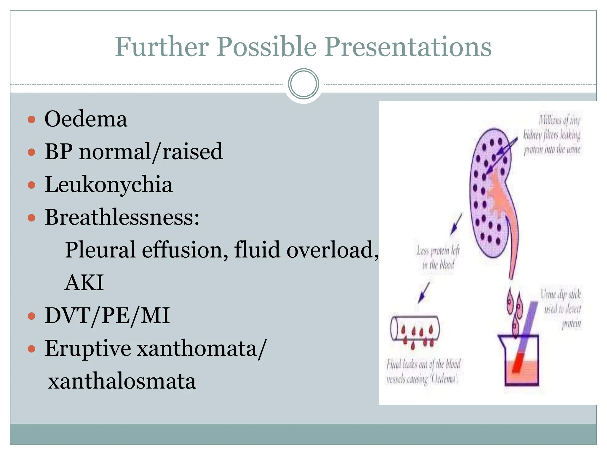 Pediatrics Nephrotic and Nephritic Syndrome 7.ppt