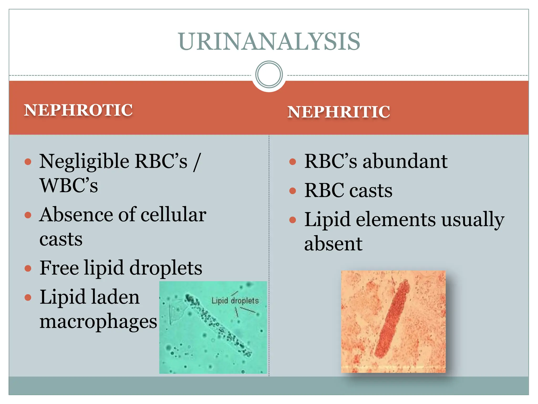 Pediatrics Nephrotic and Nephritic Syndrome 7.ppt