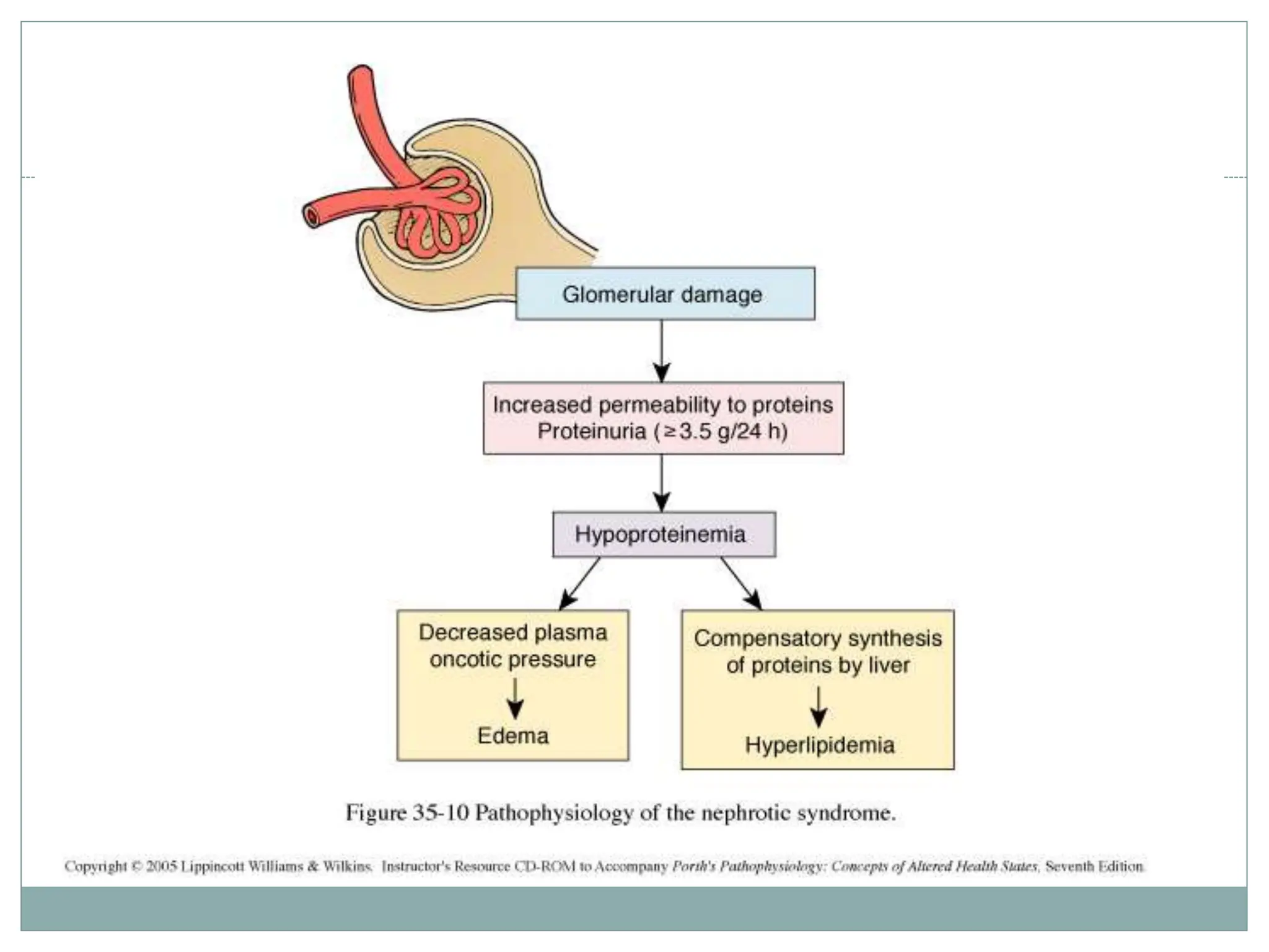 Pediatrics Nephrotic and Nephritic Syndrome 7.ppt