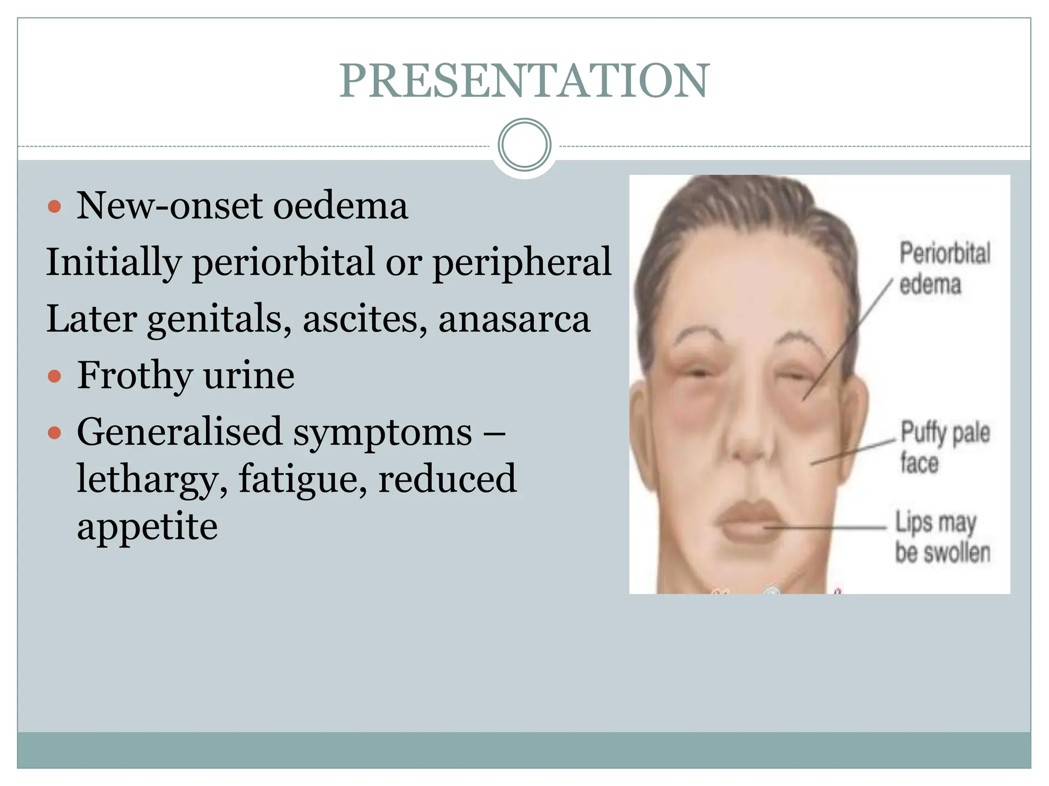 Pediatrics Nephrotic and Nephritic Syndrome 7.ppt