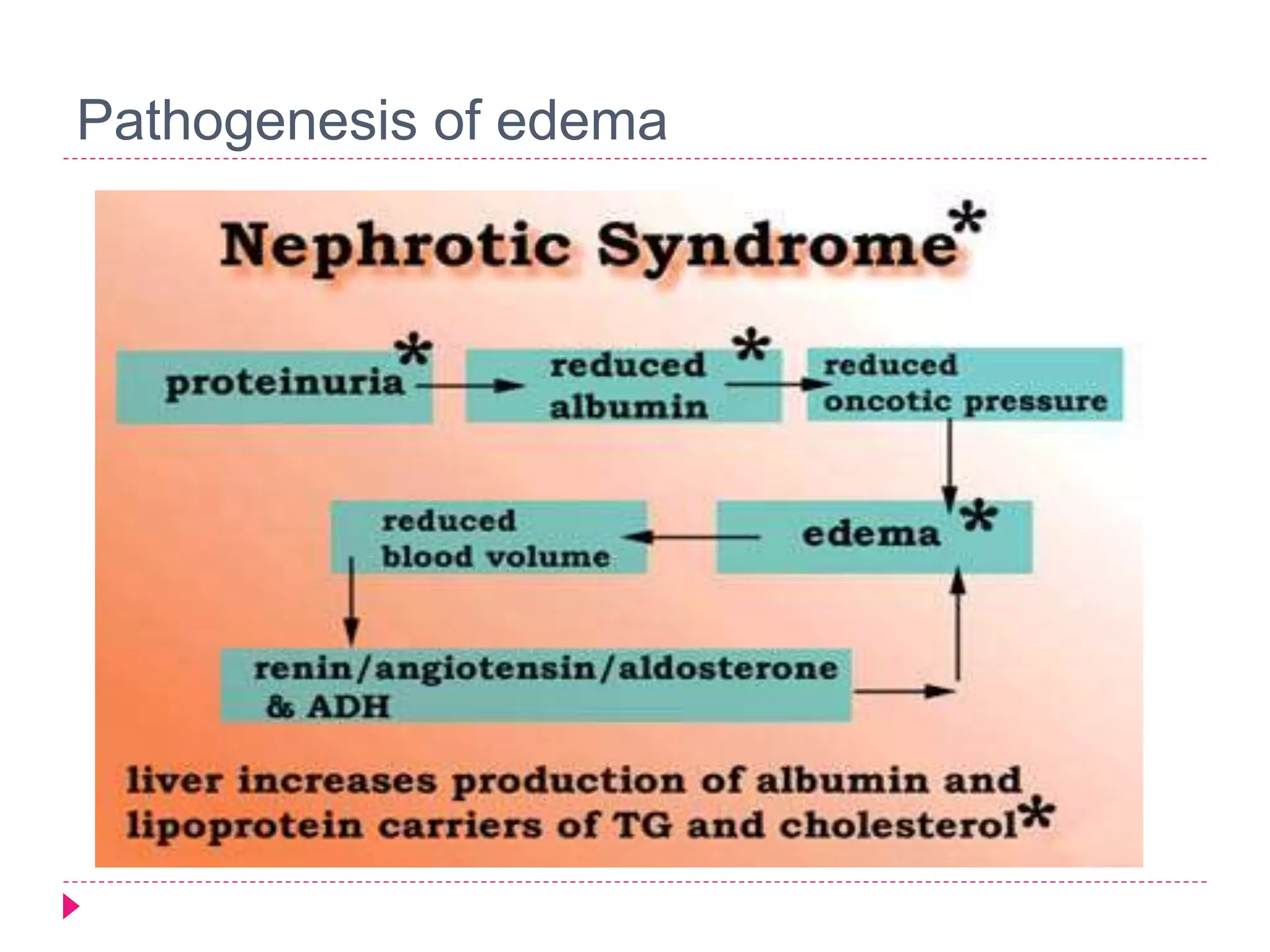 Nephrotic syndrome | PPTX