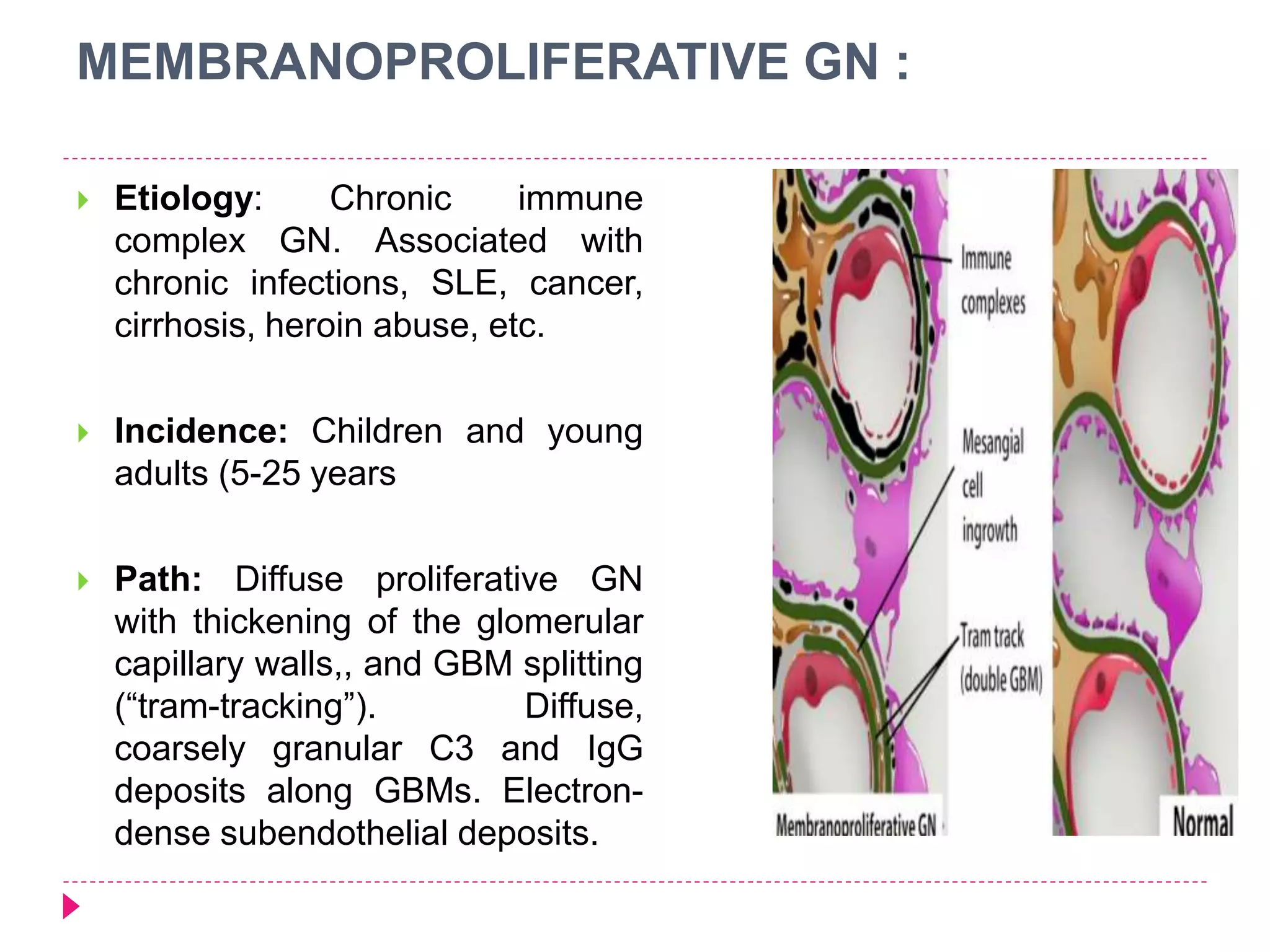 Nephrotic syndrome | PPTX