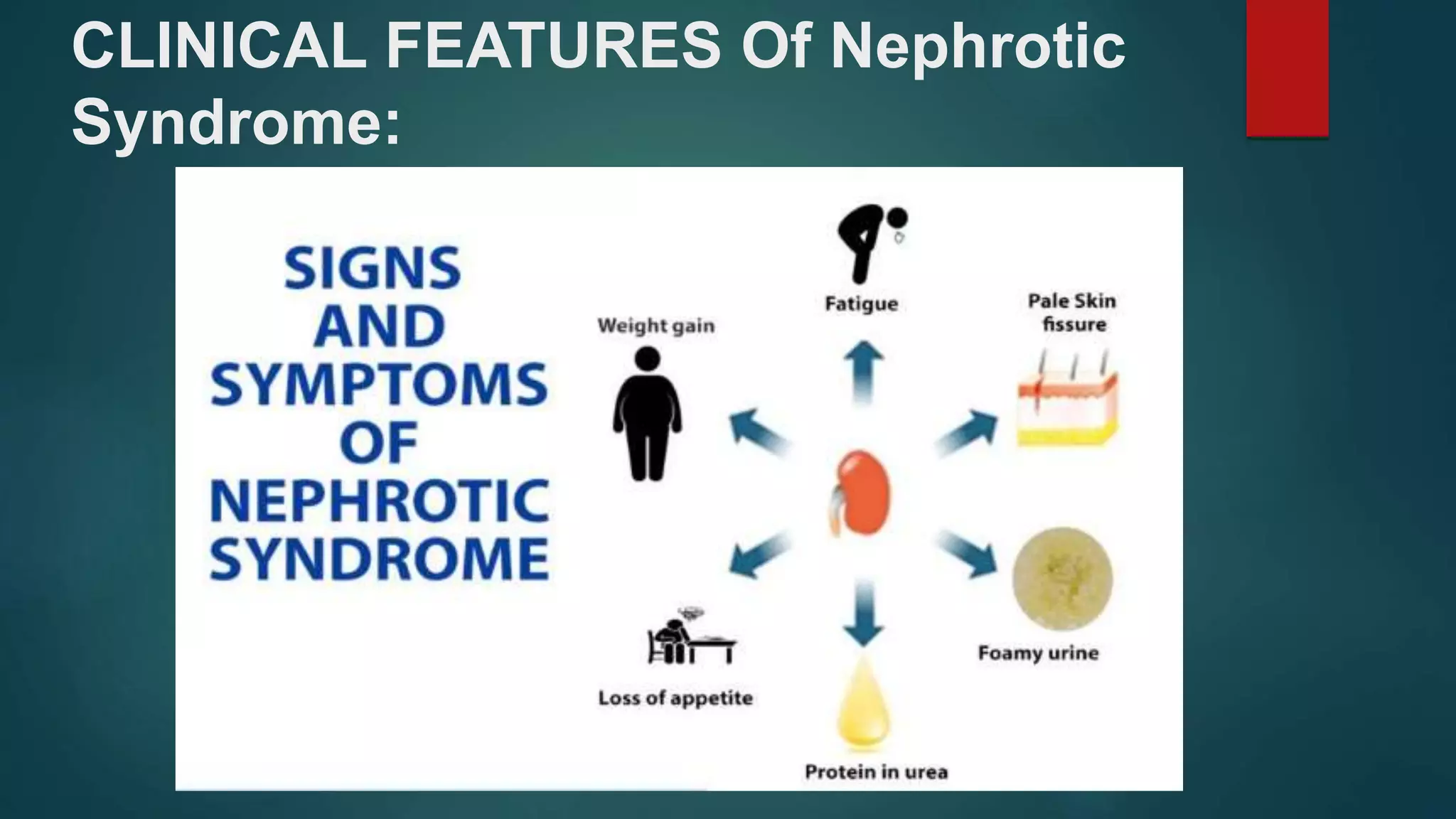 Nephrotic syndrome final shivaom | PPTX
