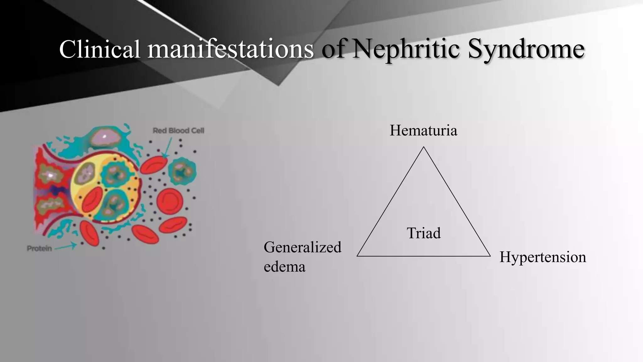Nephrotic vs nephritic.pptx