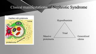 Nephrotic vs nephritic.pptx