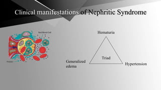 Nephrotic vs nephritic.pptx