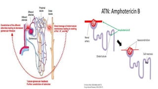 Nephrotoxins: factors that cause nephrotoxicity | PPTX