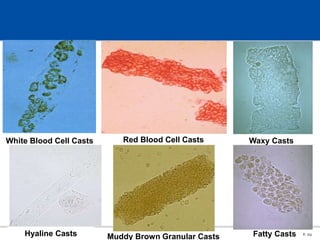 Nephrotoxins.pptx | Chemistry | Science