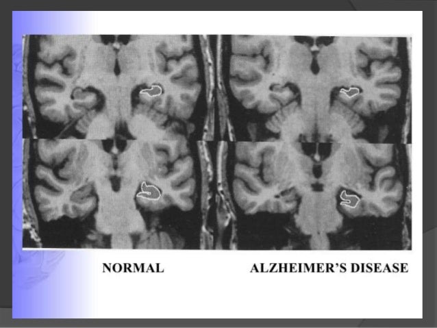 Neruoimaging Final