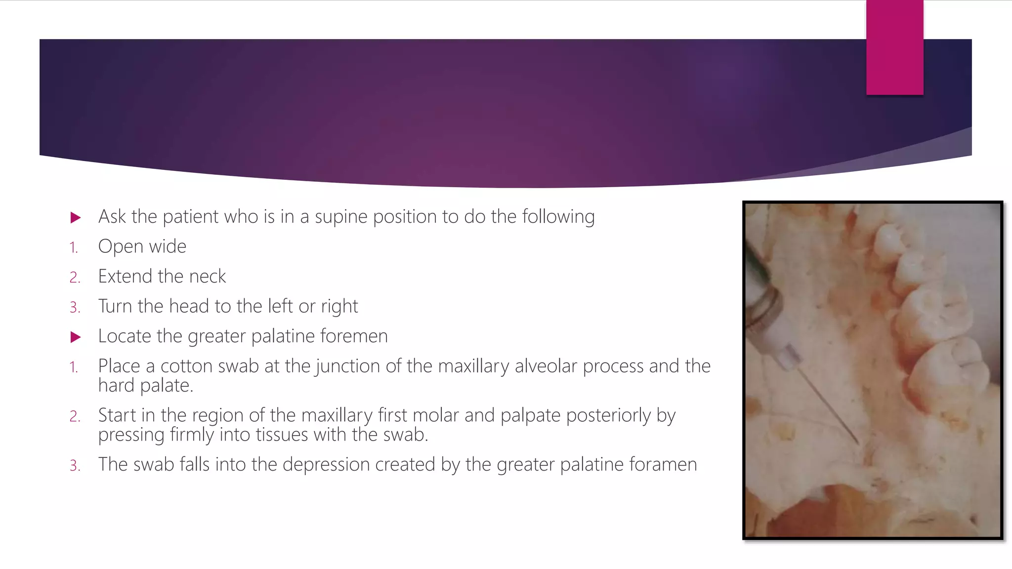 Nerv block - PSA & GREATER PALATINE NERVE BLOCK | PPTX