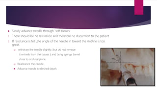 Nerv block - PSA & GREATER PALATINE NERVE BLOCK | PPTX