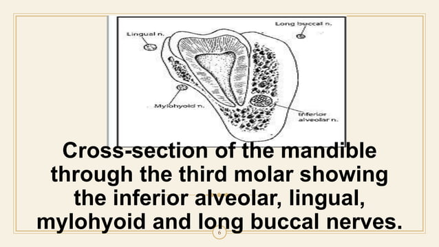 Nerve affections following extractions of lower wisdom tooth | PPT