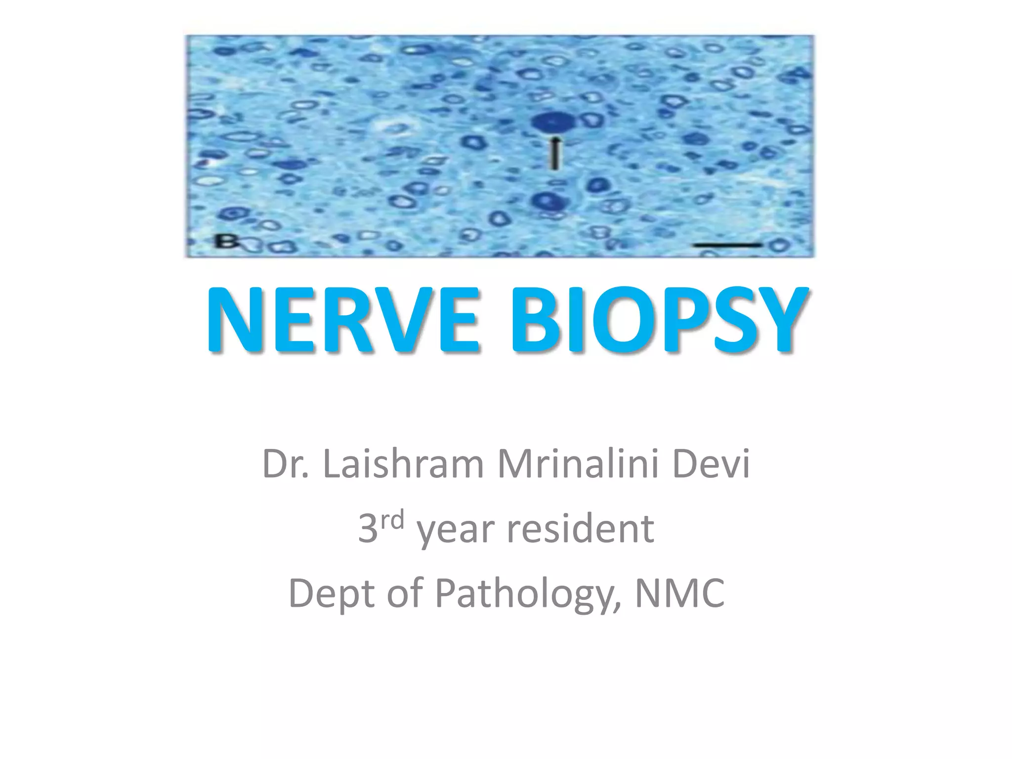 Nerve biopsy | PPTX