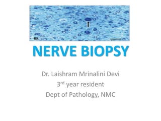 Nerve biopsy | PPTX