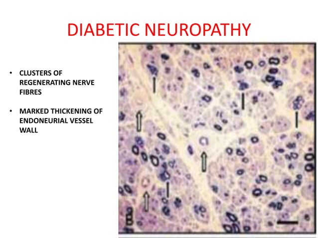 Nerve biopsy | PPTX | Brain and Nervous System Disorders | Diseases and ...