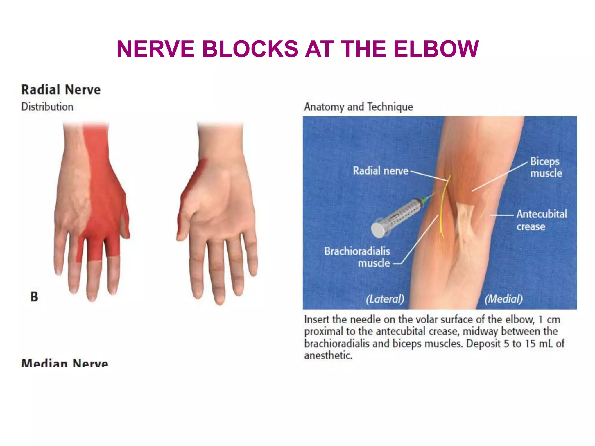 Nerve block | PPTX