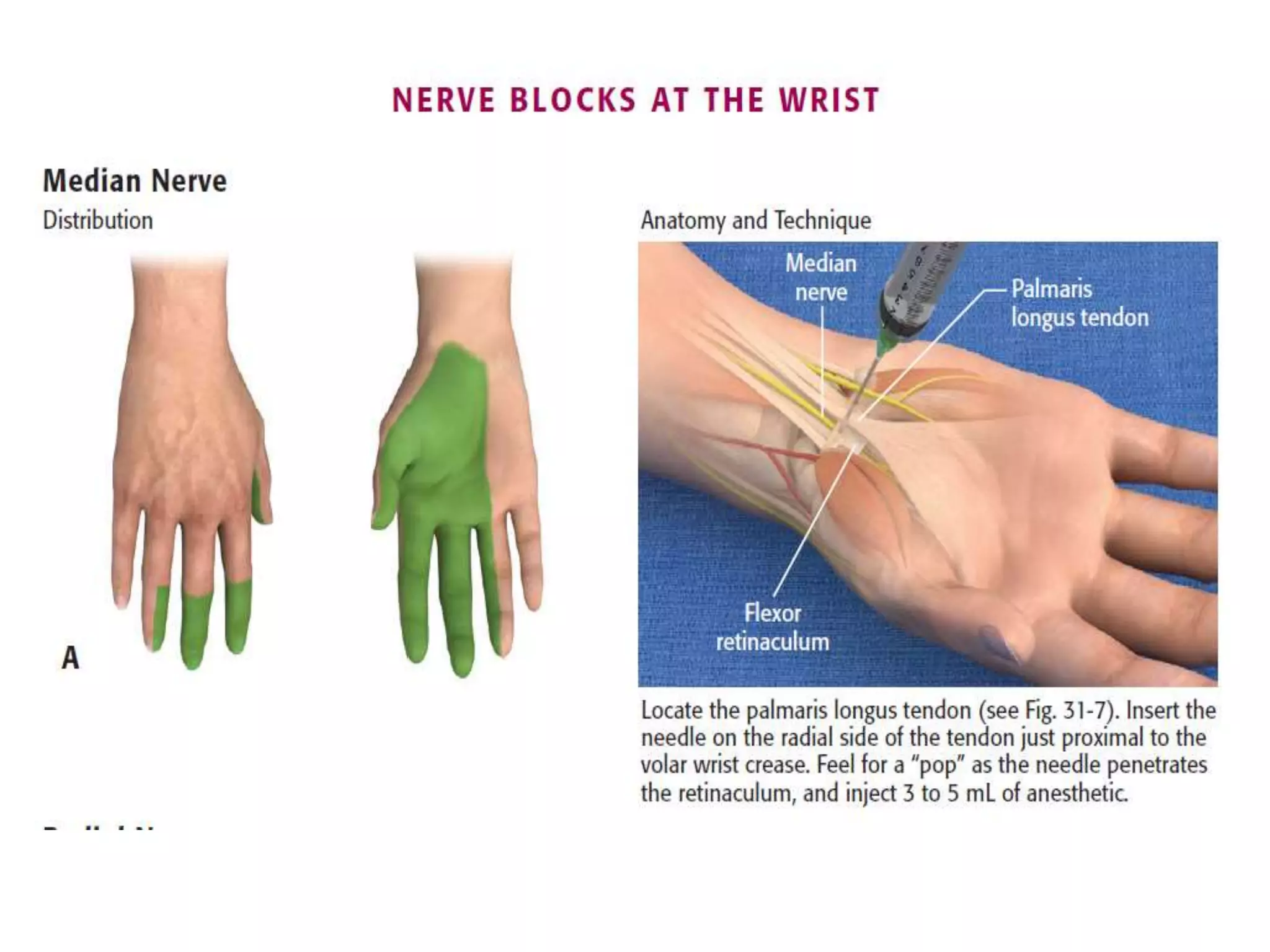 Nerve block | PPTX