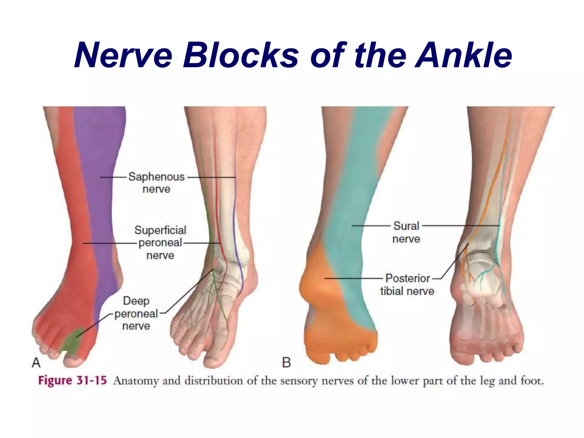 Nerve block | PPTX