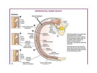 Nerve block | PPTX