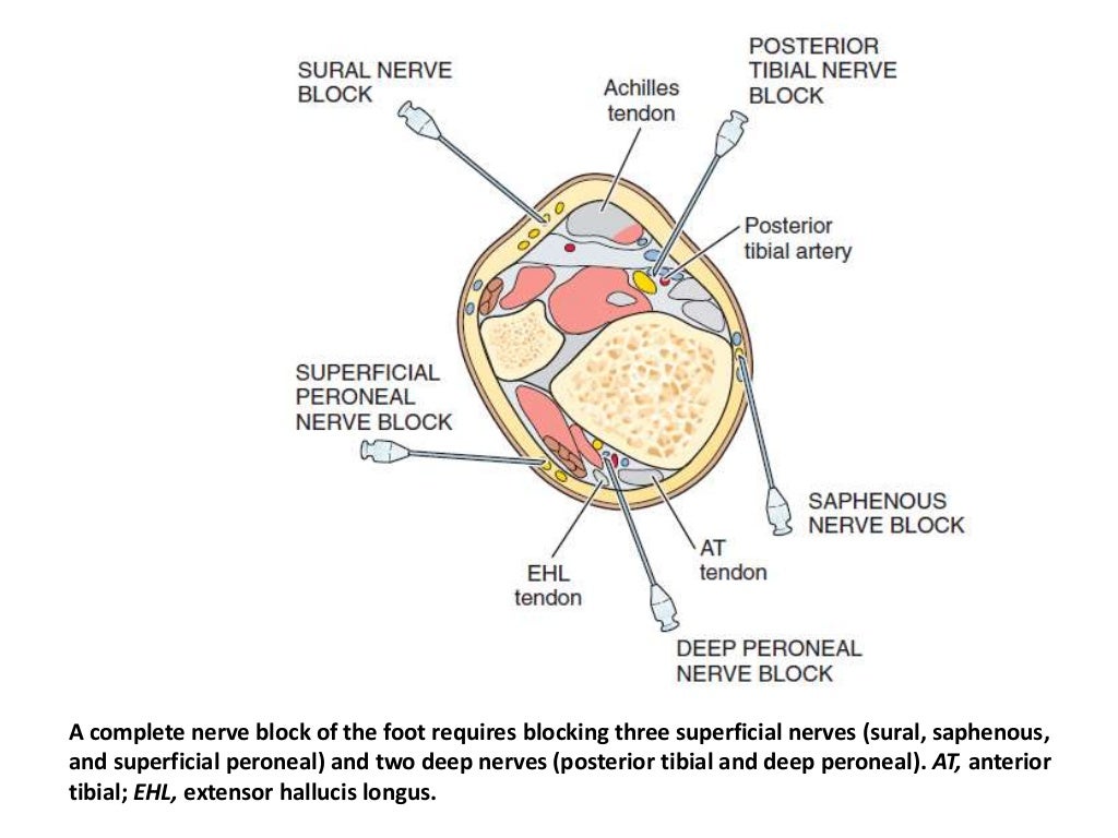 Nerve block