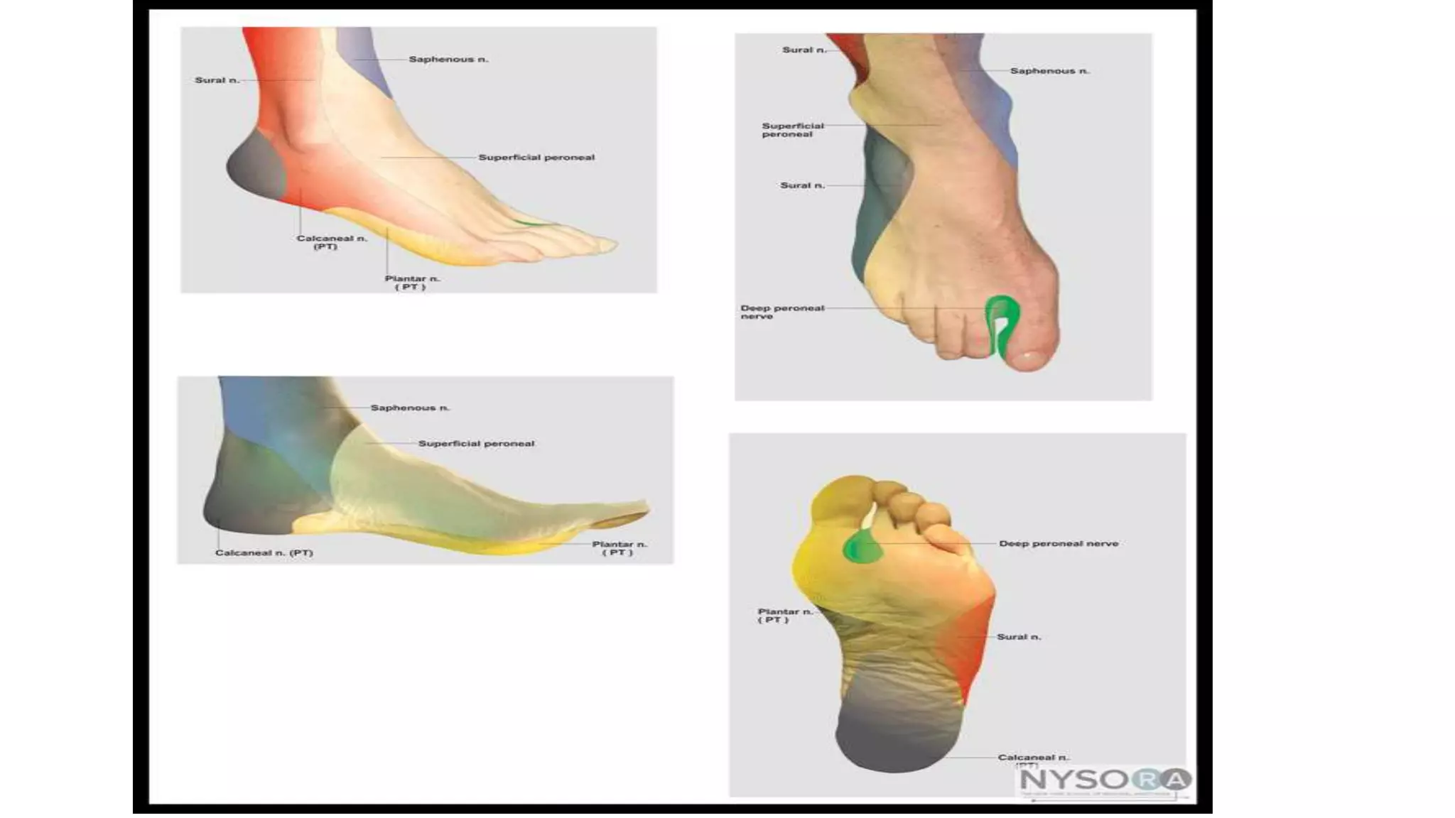 Peripheral Nerve block(ankle block,wrist block, digital block) | PPTX