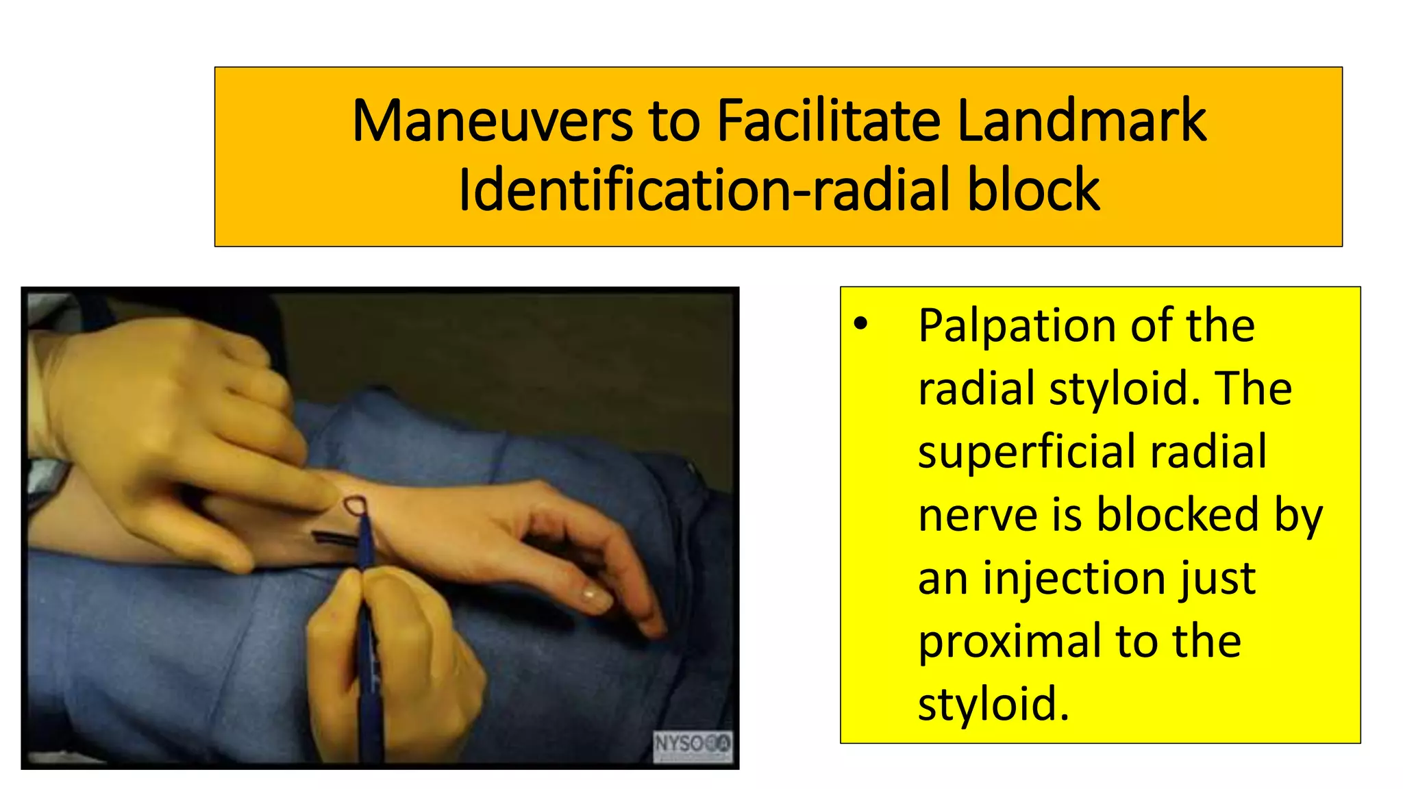 Peripheral Nerve block(ankle block,wrist block, digital block) | PPTX
