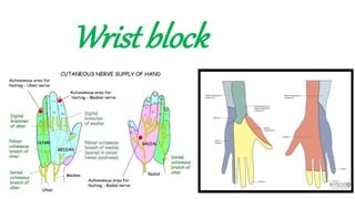Peripheral Nerve block(ankle block,wrist block, digital block) | PPTX
