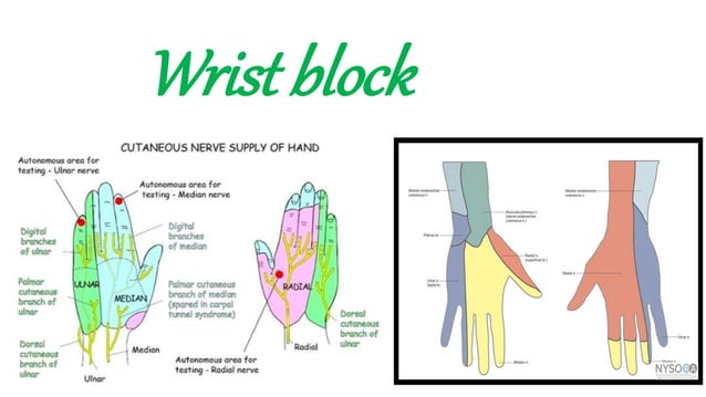 Peripheral Nerve block(ankle block,wrist block, digital block) | PPTX ...