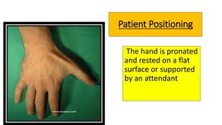 Peripheral Nerve block(ankle block,wrist block, digital block) | PPTX