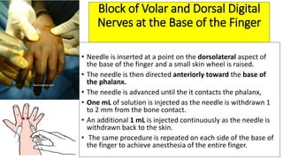 Peripheral Nerve block(ankle block,wrist block, digital block) | PPTX