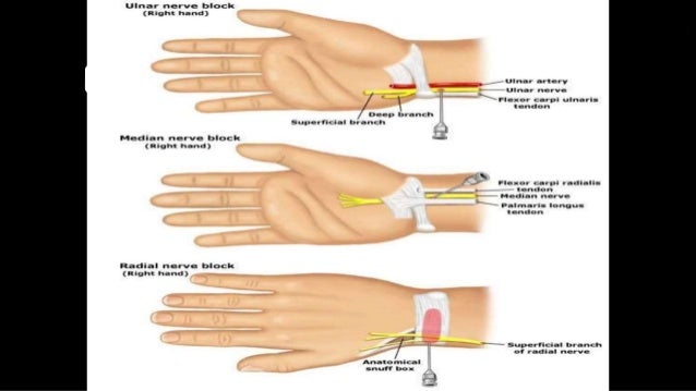 Peripheral Nerve block(ankle block,wrist block, digital block)