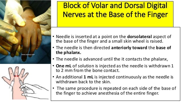 Peripheral Nerve block(ankle block,wrist block, digital block)
